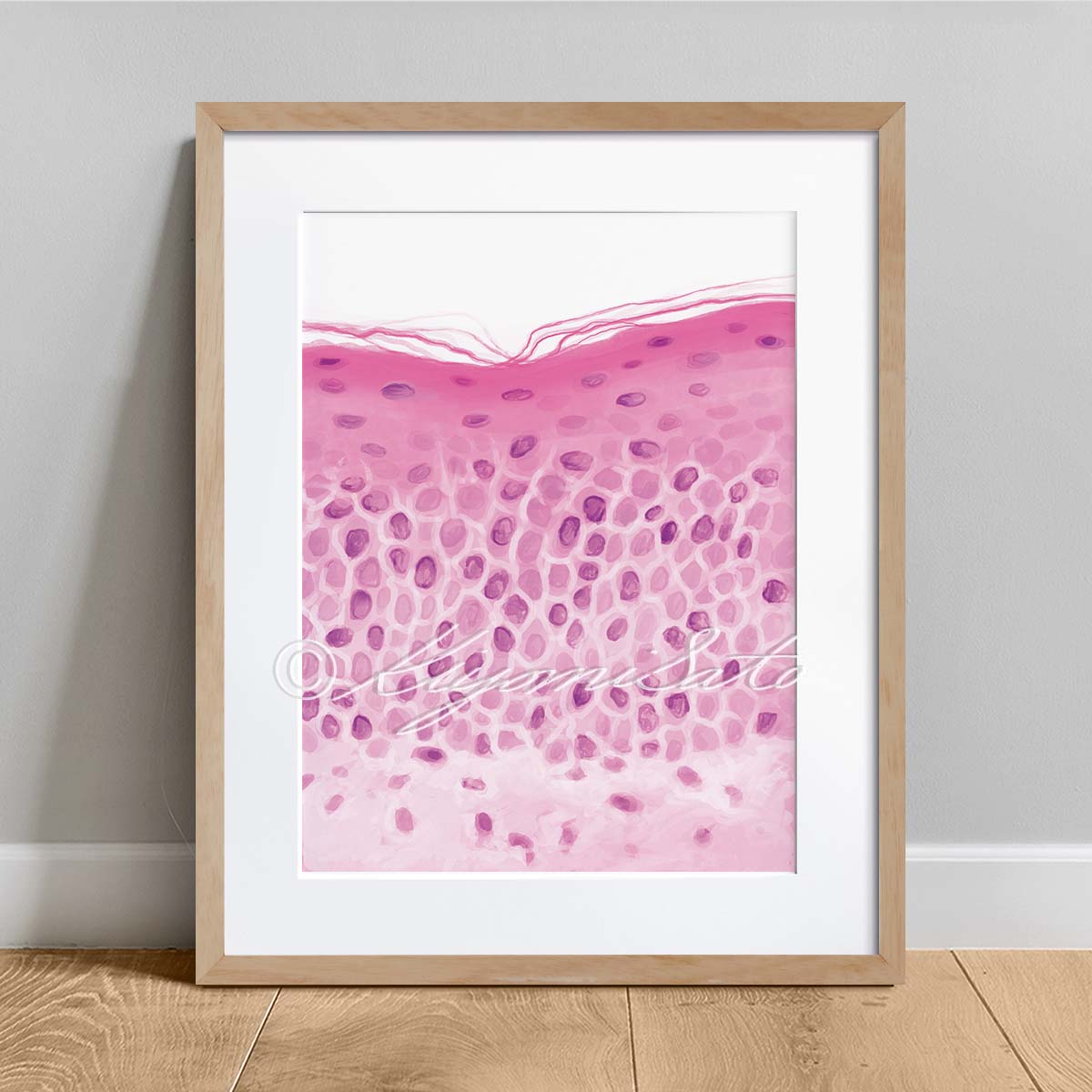 Parakeratosis pathology art print – The Forest Cloak
